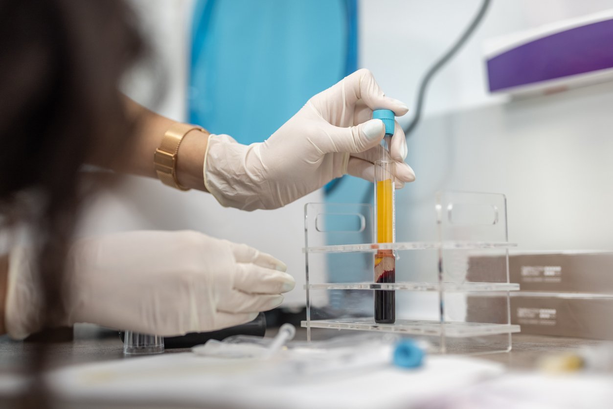 Human Plasma | Precision for Medicine